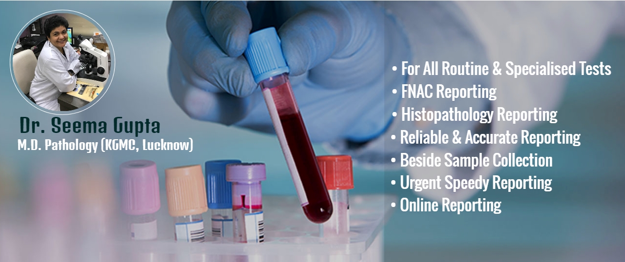 Best Pathology Lab in Raj Nagar Ghaziabad – Sharnam Pathology Services ...